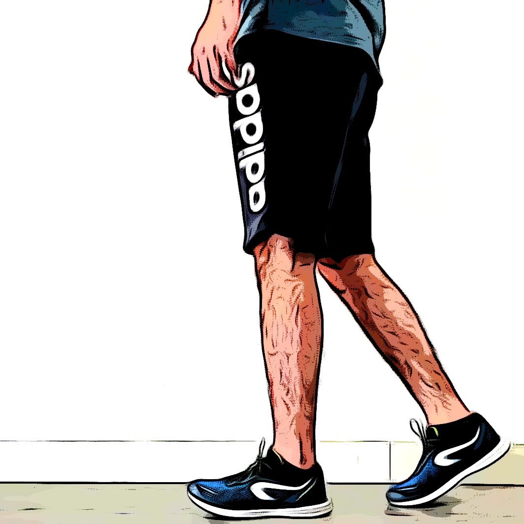 Le talon pointe en running expliqué par un coach sportif