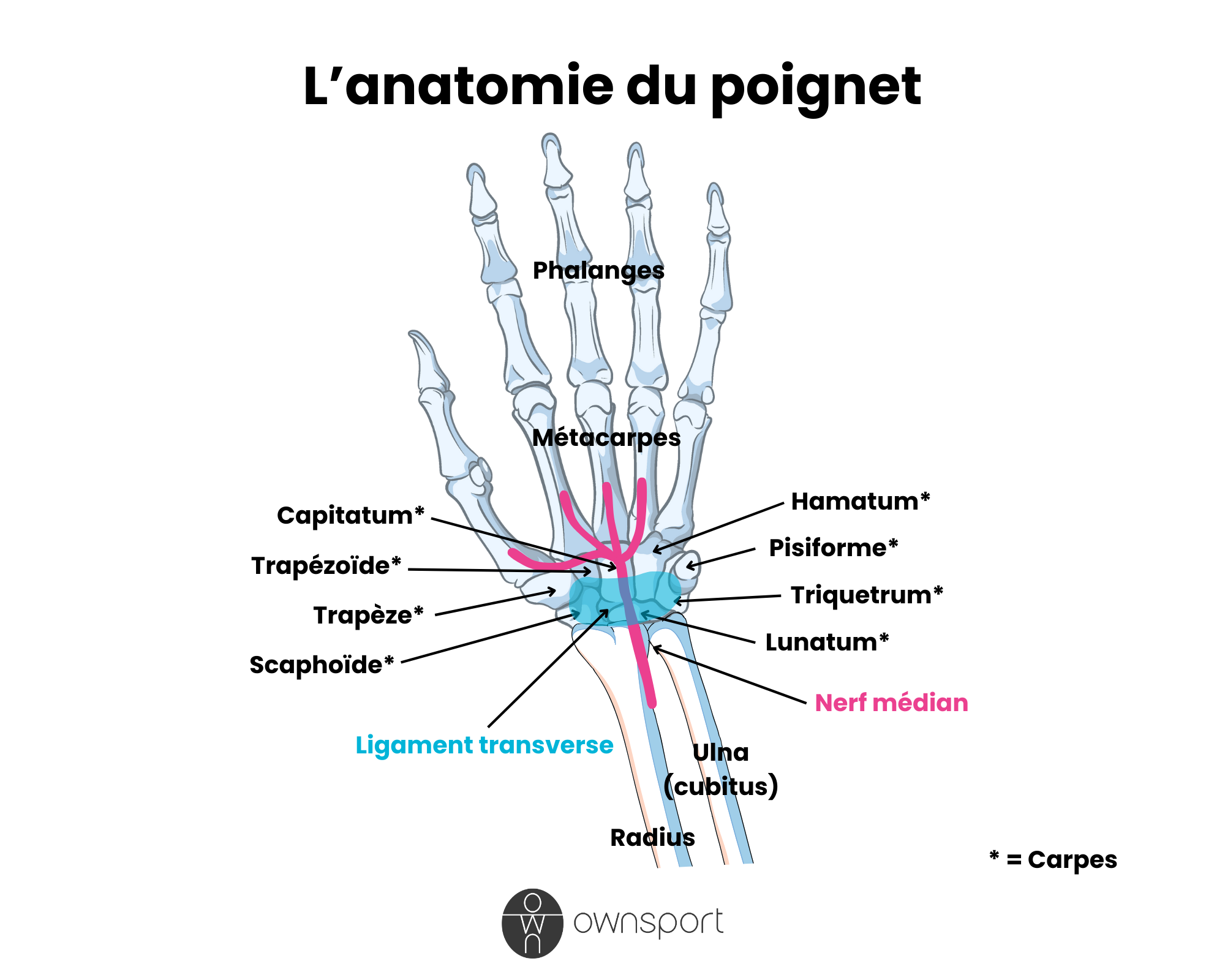 Soigner une fracture du poignet : le guide